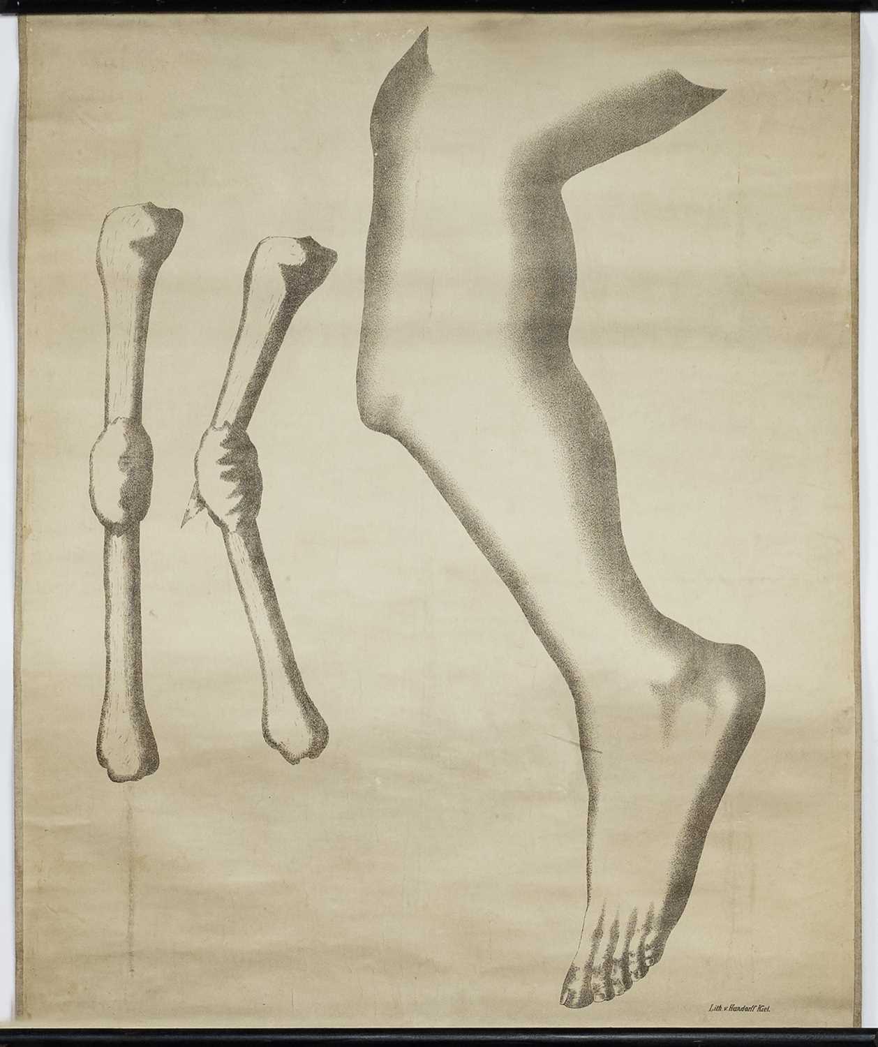 Lot 85 - 19TH CENTURY MEDICAL ROLLER CHART